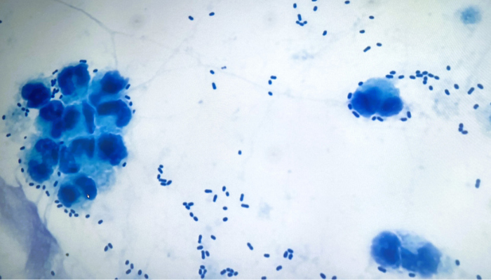 Body Fluid Analysis | Clinical Pathology