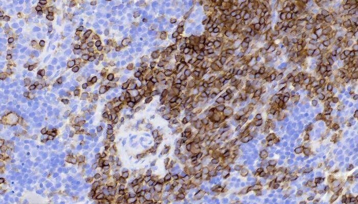 HALO Digital Image Analysis | Histopathology