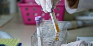 Body Fluid Analysis | Clinical Pathology