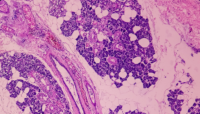 HALO Digital Image Analysis | Histopathology