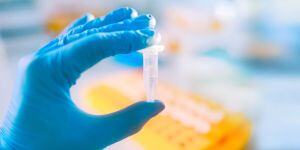 STAT-Endo™ Endotoxin Testing | Biologics & Cell Health